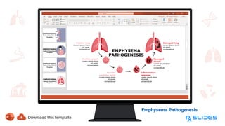 Emphysema | PPT