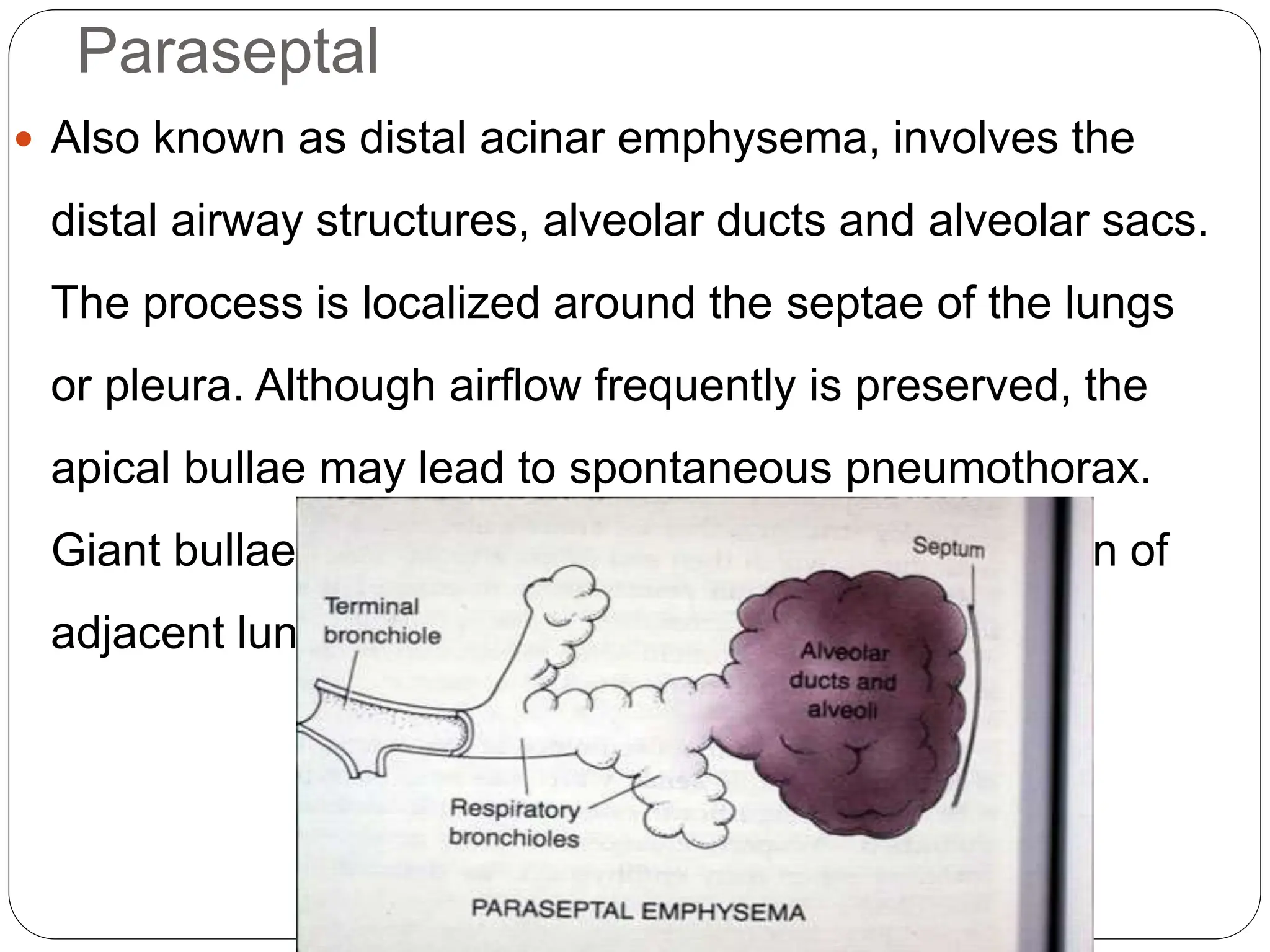 Nursing Care of Emphysema patient .pptx
