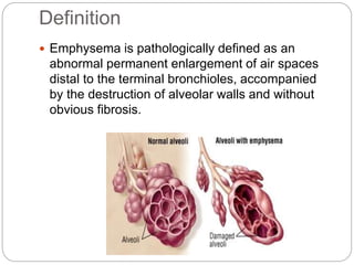Nursing Care of Emphysema patient .pptx