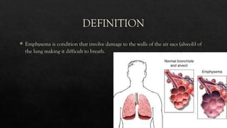 Emphysema.pptxjhyg87tguyguyfgi7yrrdgfdyt | PPT