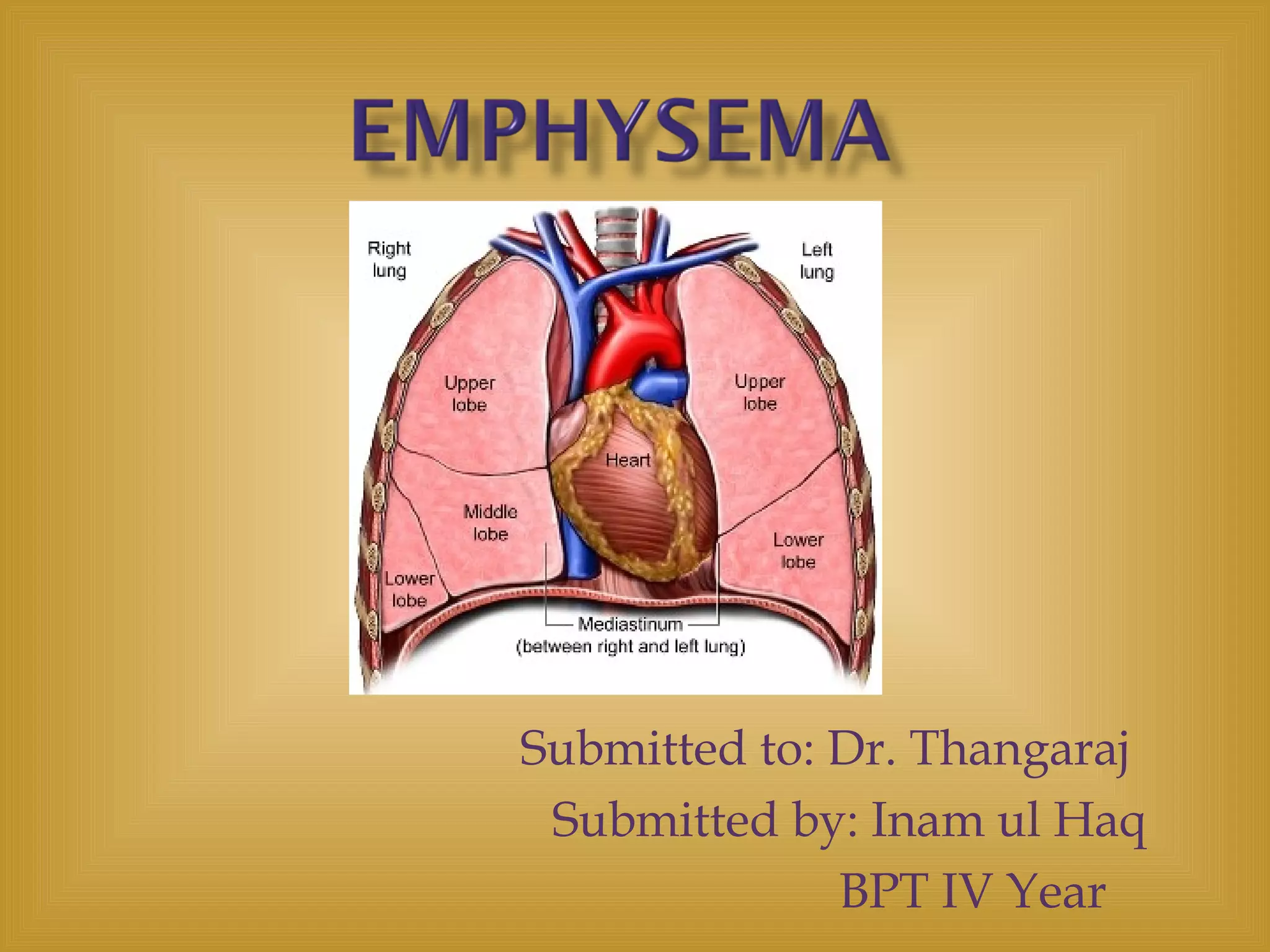Emphysema (C.O.P.D.) | PPT