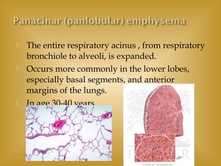 Emphysema (C.O.P.D.) | PPT