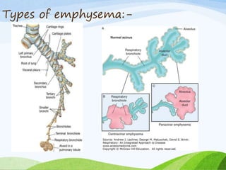 COPD (chronic obstructive pulmonary disease) | PPT