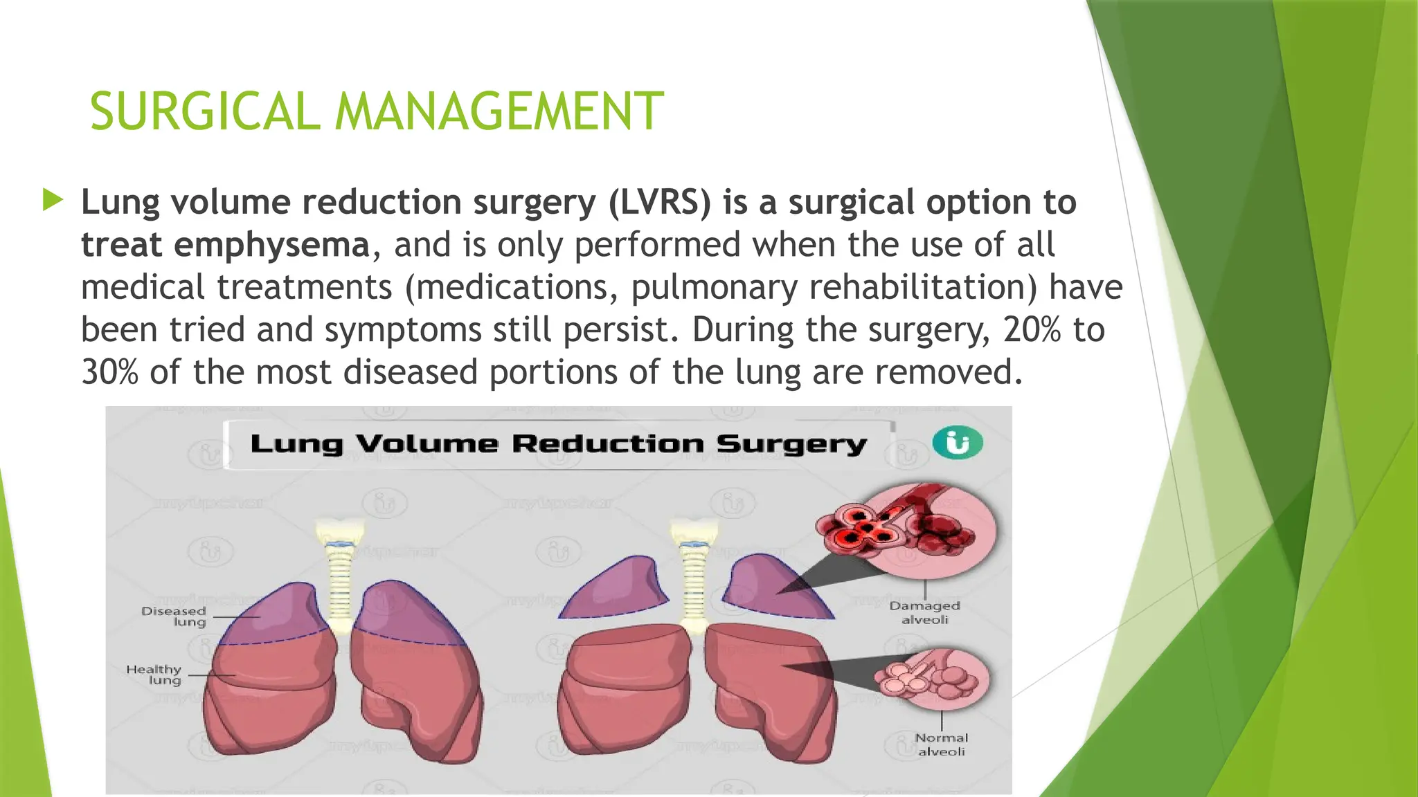 emphysema by Raafat Al-Awadhi for nursing.pptx