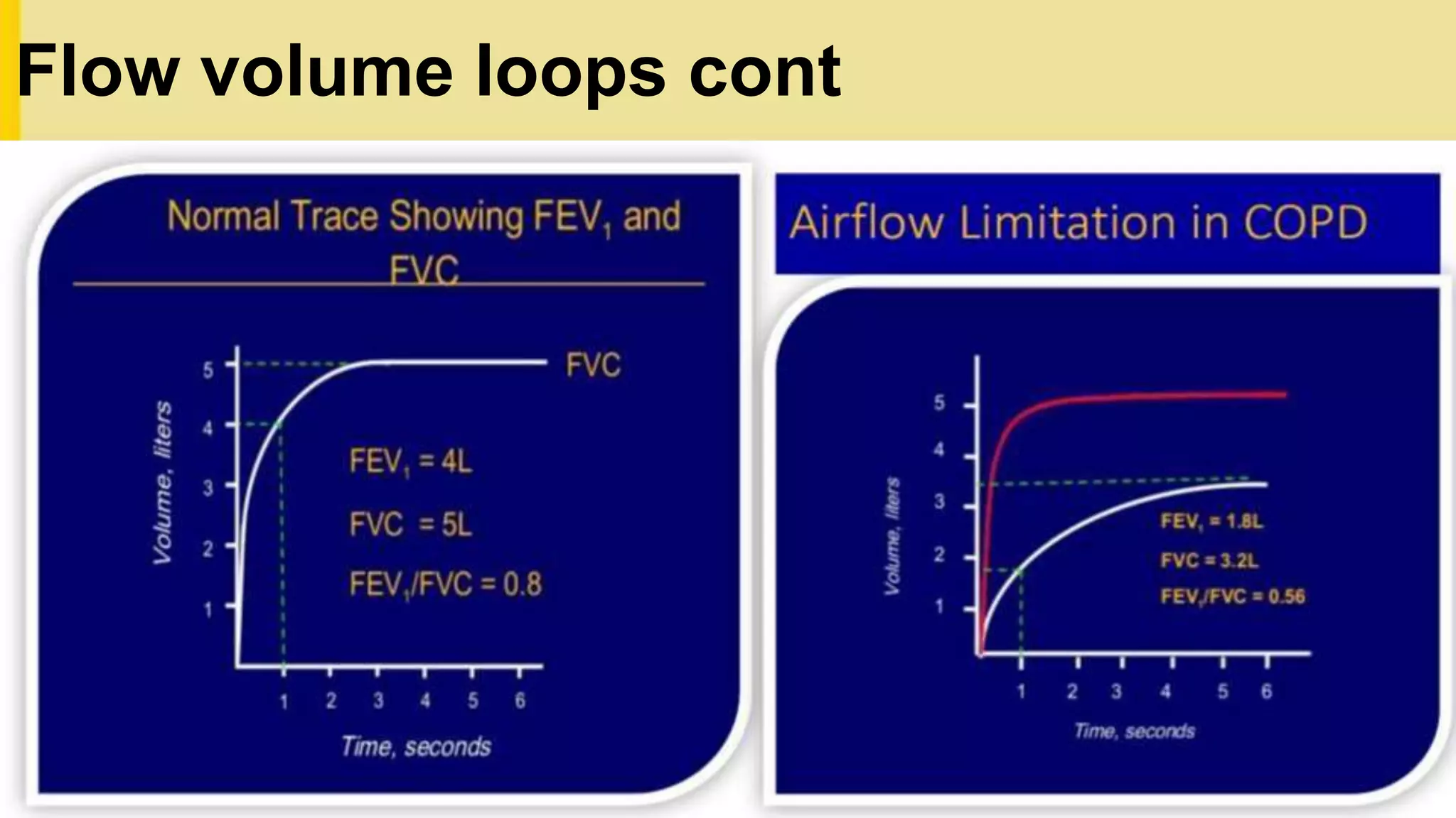 emphysema case study cog10.pptx