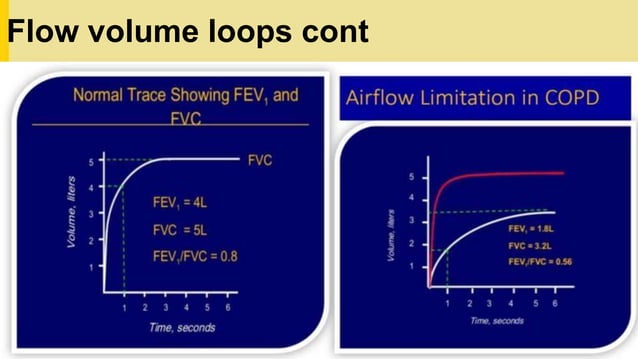 emphysema case study cog10.pptx