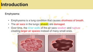 emphysema case study cog10.pptx