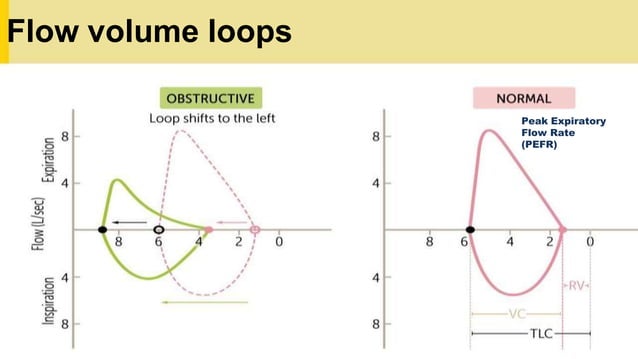 emphysema case study cog10.pptx