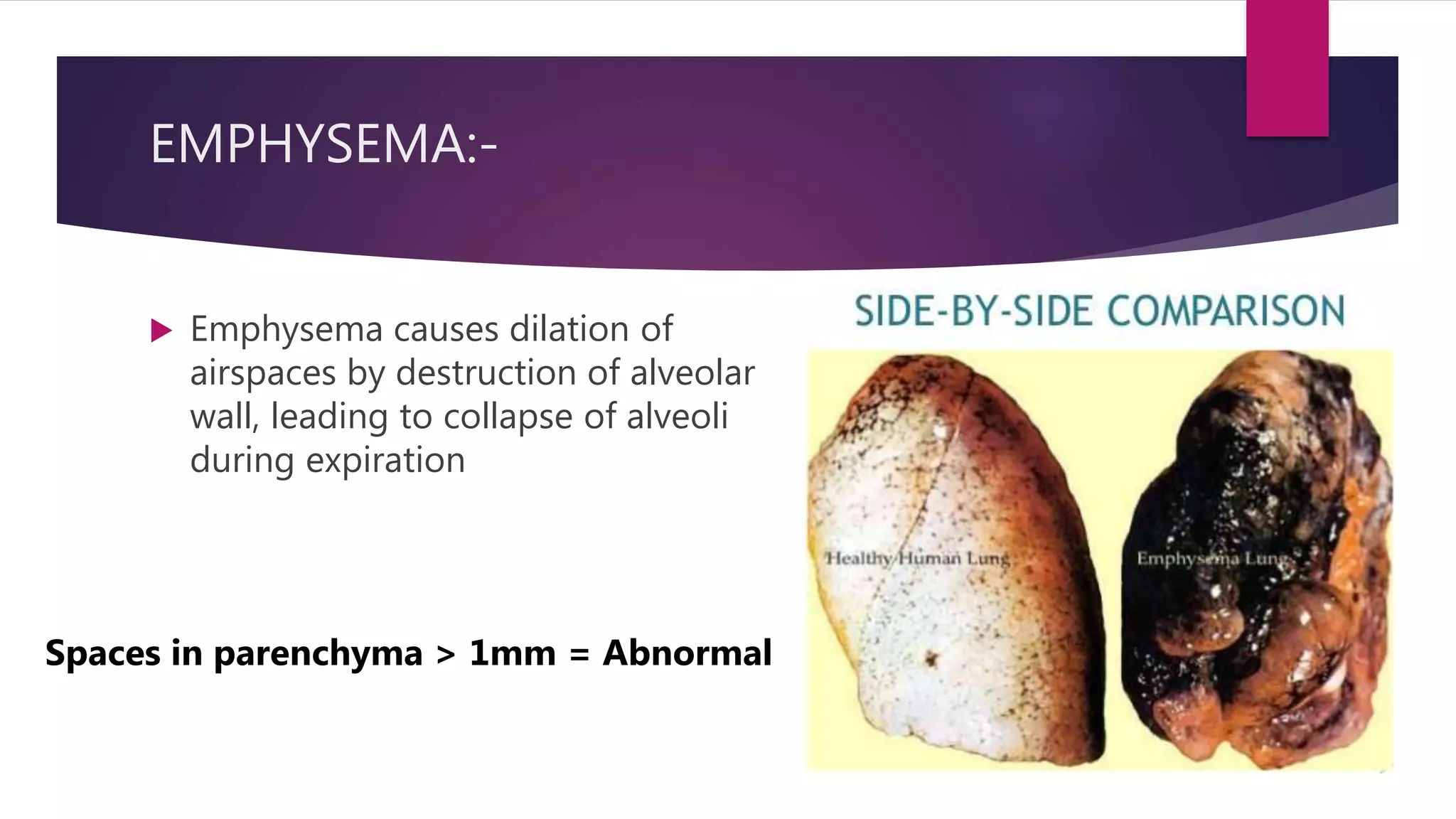 Emphysema and chronic bronchitis | PPT