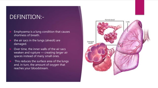 Emphysema and chronic bronchitis | PPT