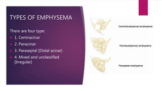 Emphysema and chronic bronchitis | PPT