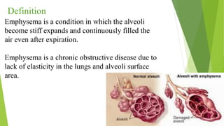 Emphysema PPT | PPTX