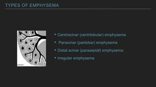 EMPHYSEMA | PPTX
