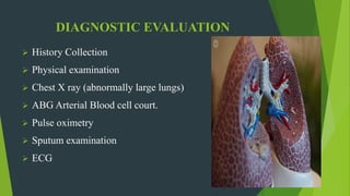 NURSING MANAGEMENT OF PATIENT WITH EMPHYSEMA .PPT