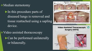 NURSING MANAGEMENT OF PATIENT WITH EMPHYSEMA .PPT