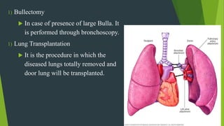 NURSING MANAGEMENT OF PATIENT WITH EMPHYSEMA .PPT