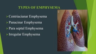 NURSING MANAGEMENT OF PATIENT WITH EMPHYSEMA .PPT