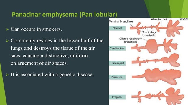 NURSING MANAGEMENT OF PATIENT WITH EMPHYSEMA .PPT | Lung and ...
