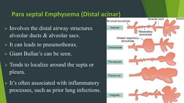 NURSING MANAGEMENT OF PATIENT WITH EMPHYSEMA .PPT | Lung and ...