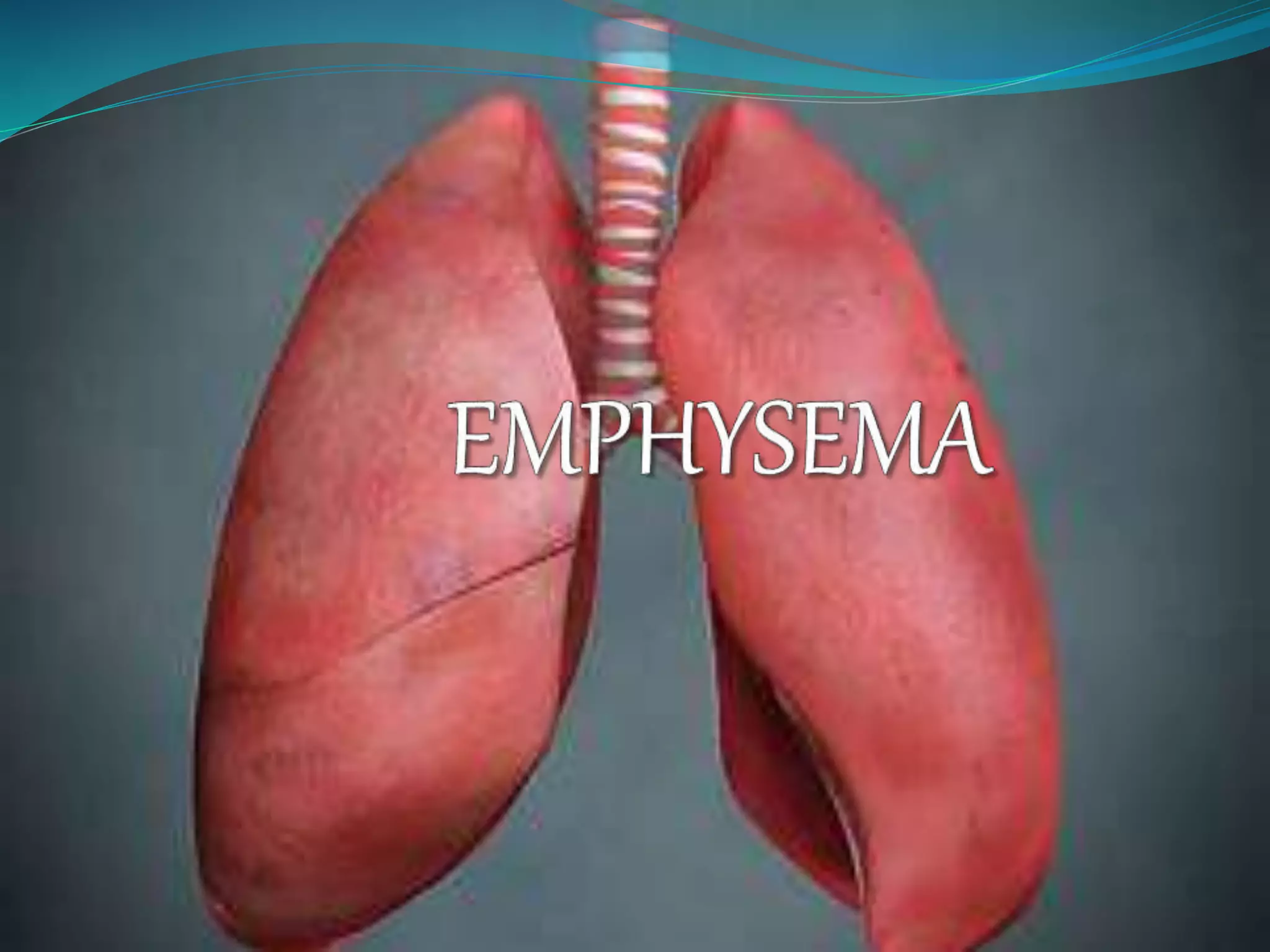Emphysema ppt | PPTX