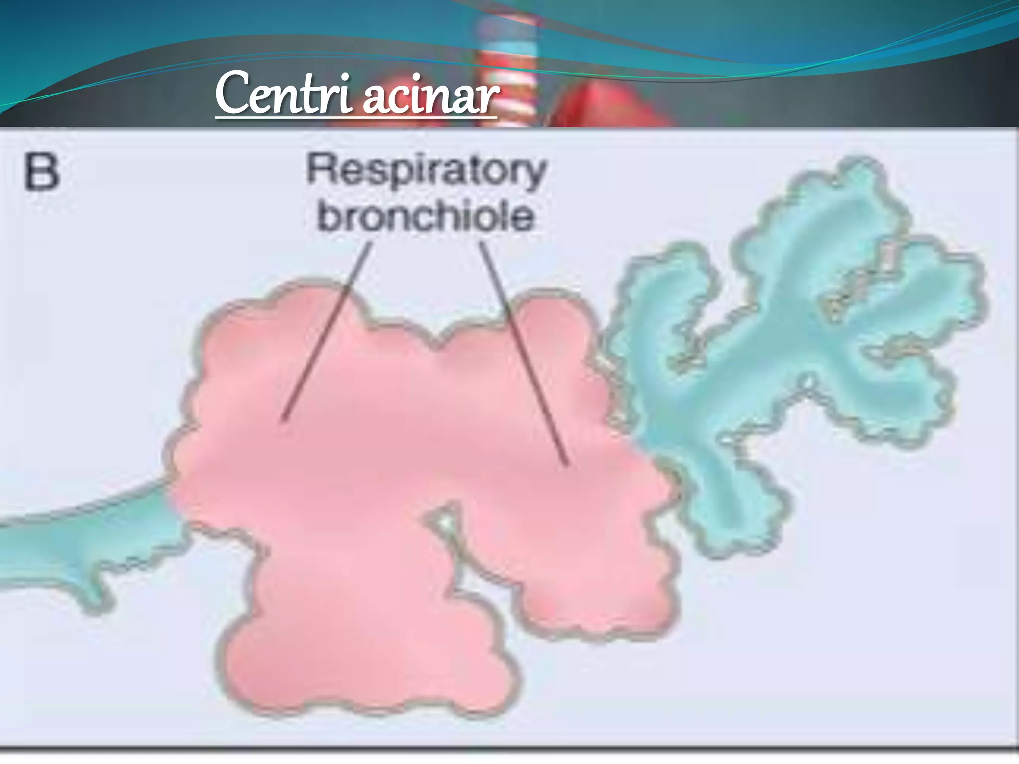 Emphysema ppt | PPTX