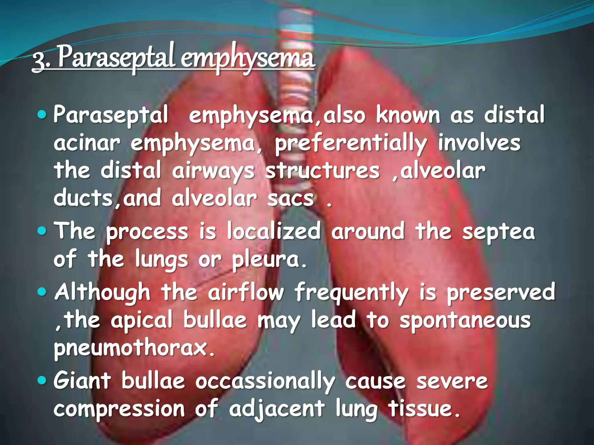 Emphysema ppt | PPTX