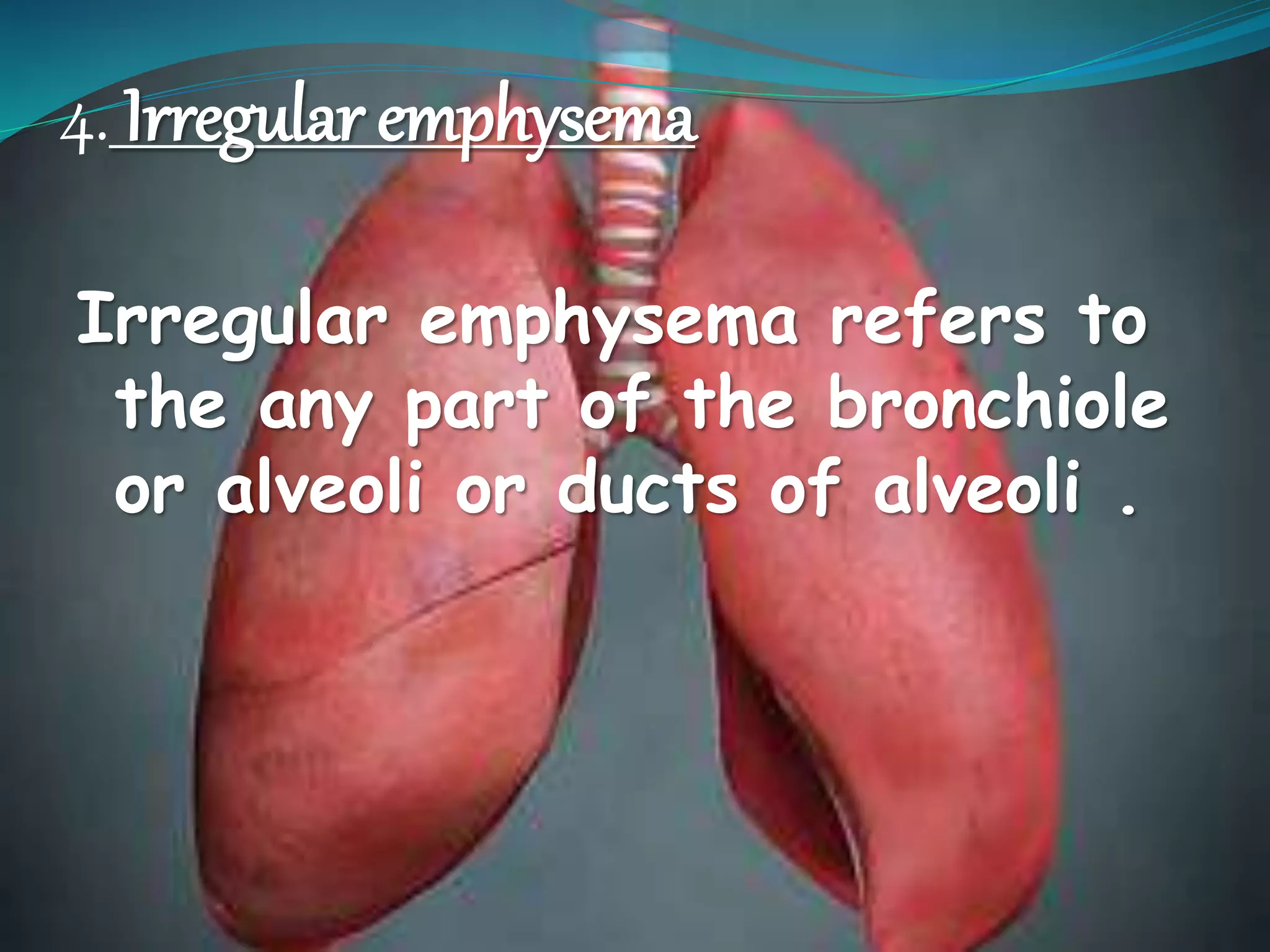 Emphysema ppt | PPTX