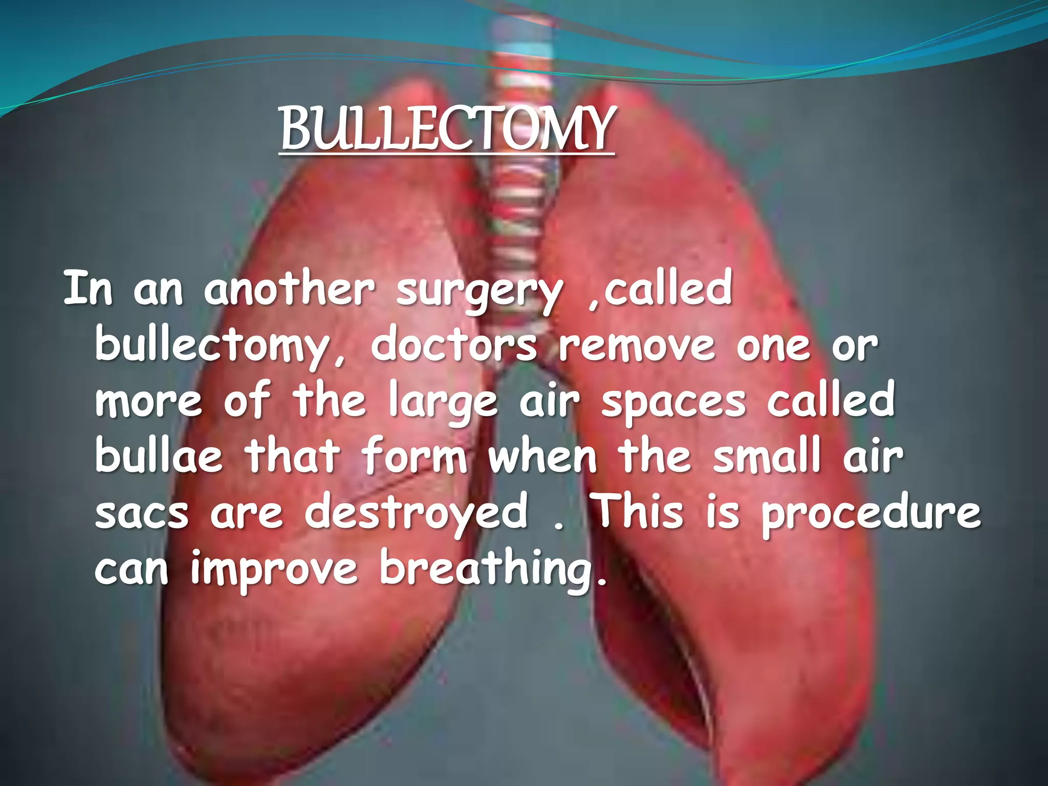 Emphysema ppt | PPTX