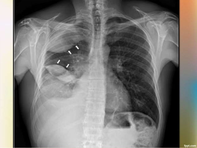 Adrian Ramírez Vázquez | Adrián Ramírez Vázquez