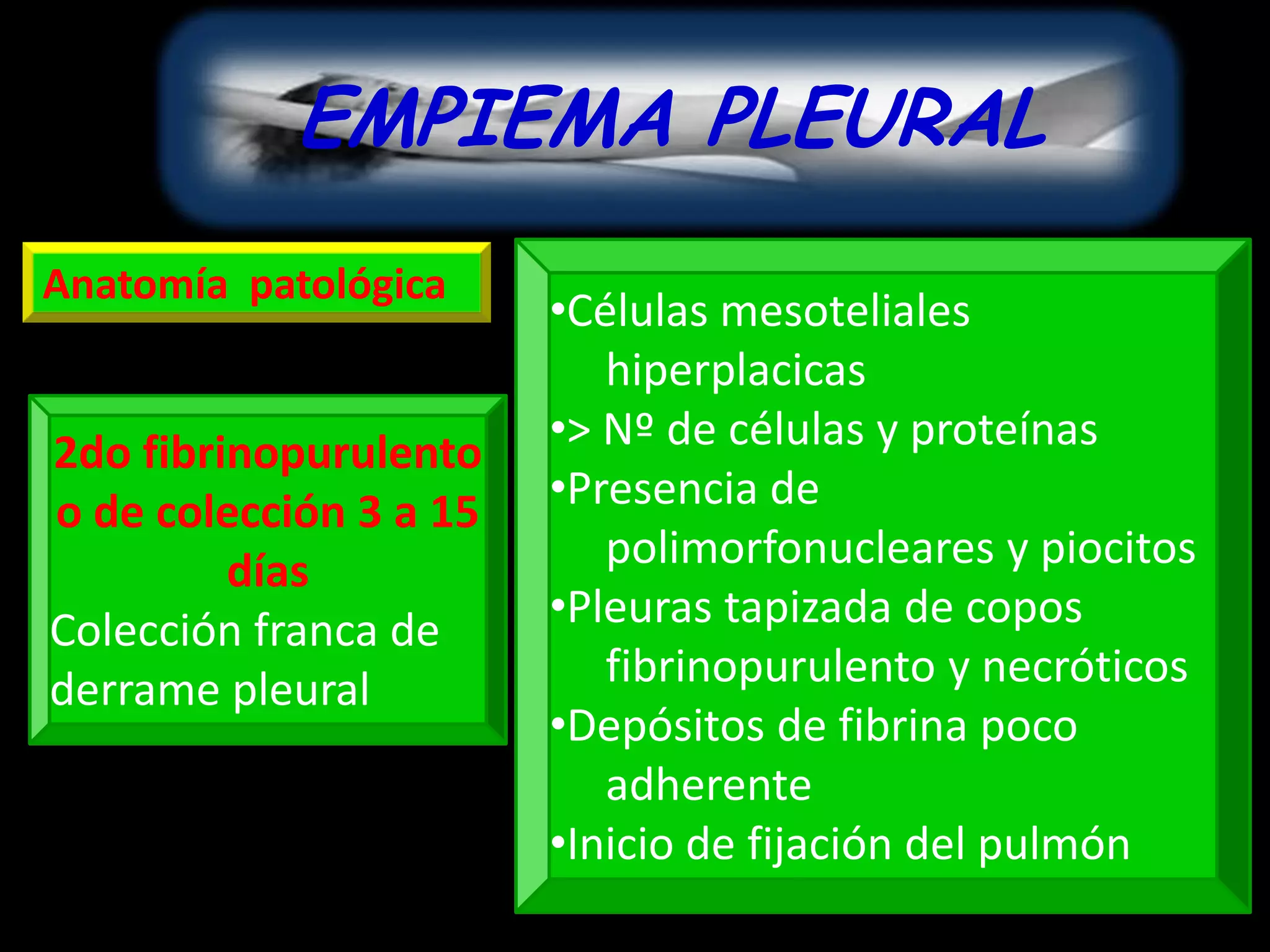 Empiema pleural | PPTX