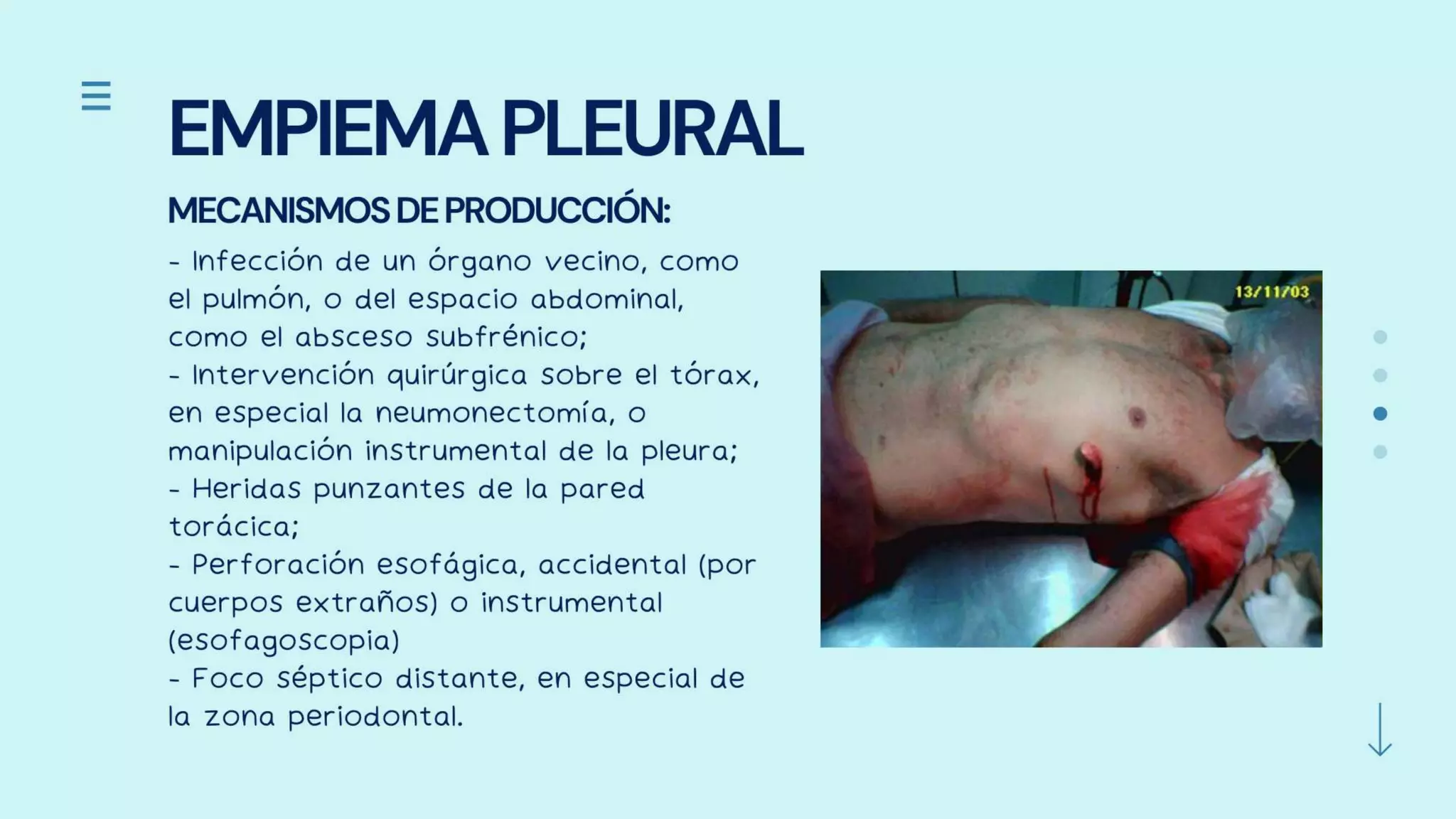 Empiema pleural | PPTX