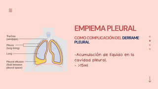 Empiema pleural | PPTX
