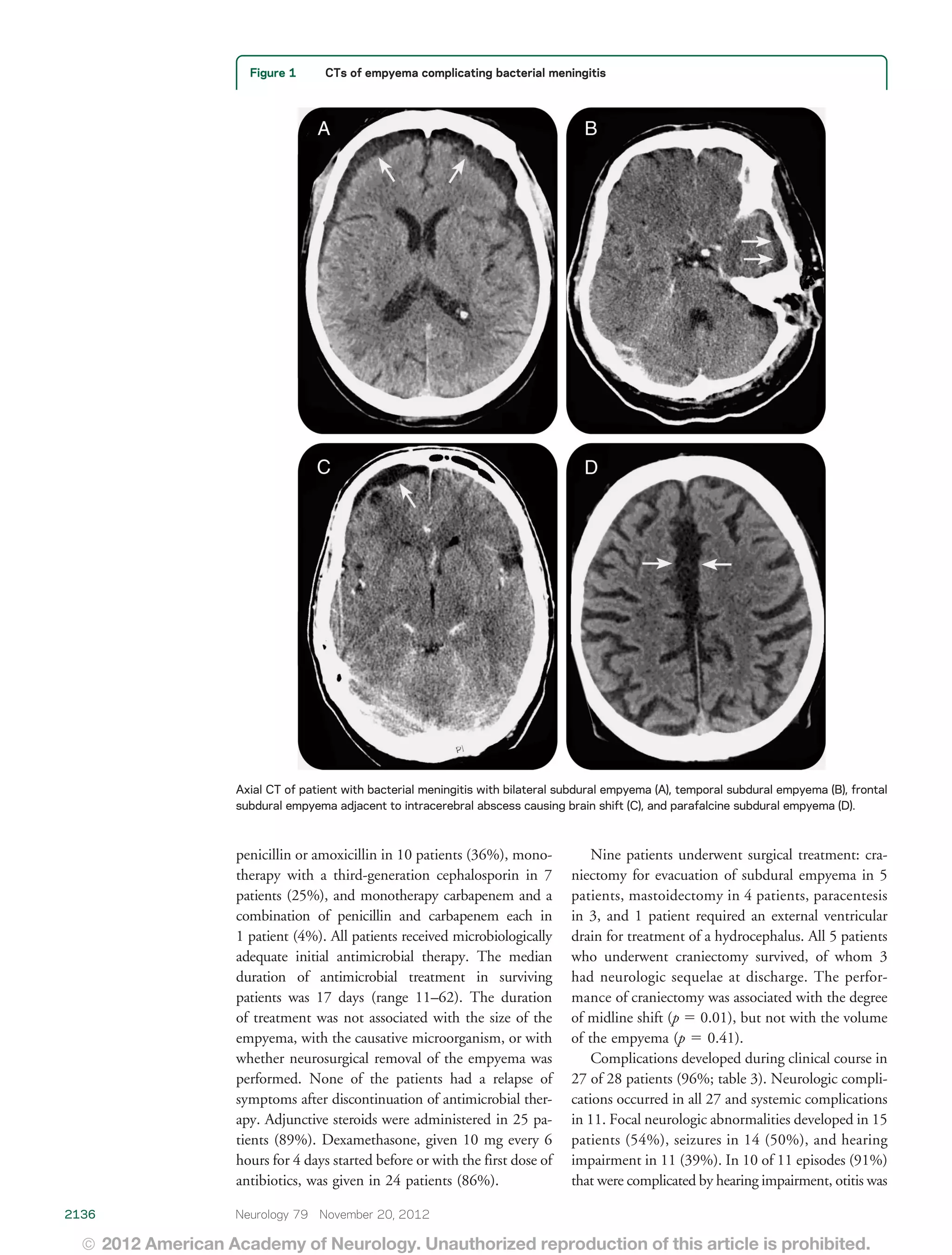 Empiema subdural en meningitis bacteriana aguda 2012 | PDF