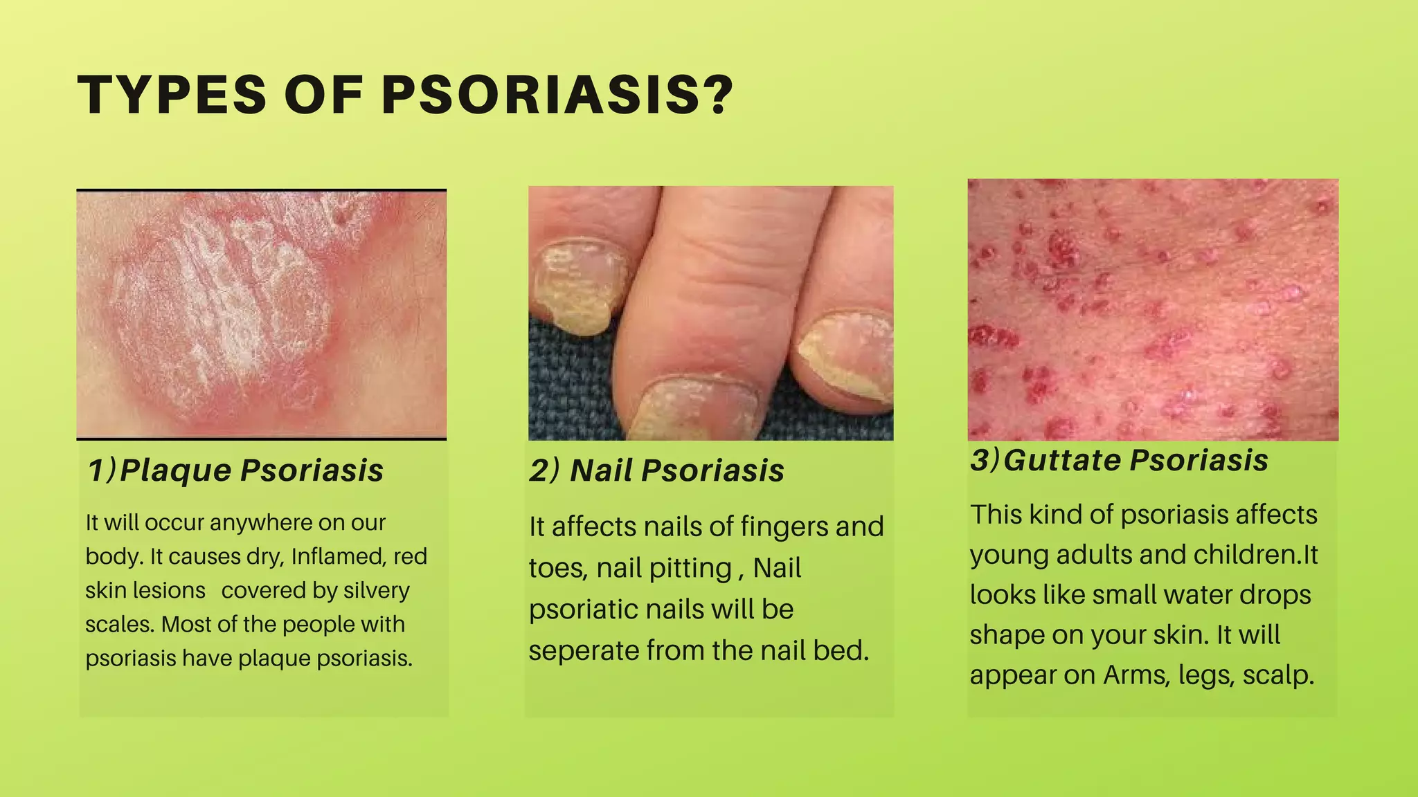 psoriasis permanently cure herbal products in india | PDF