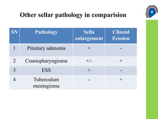 Empty sella syndrome | PPTX