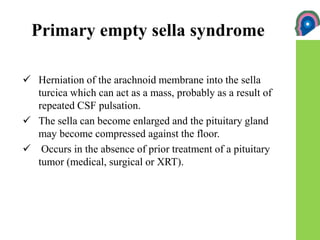 Empty sella syndrome