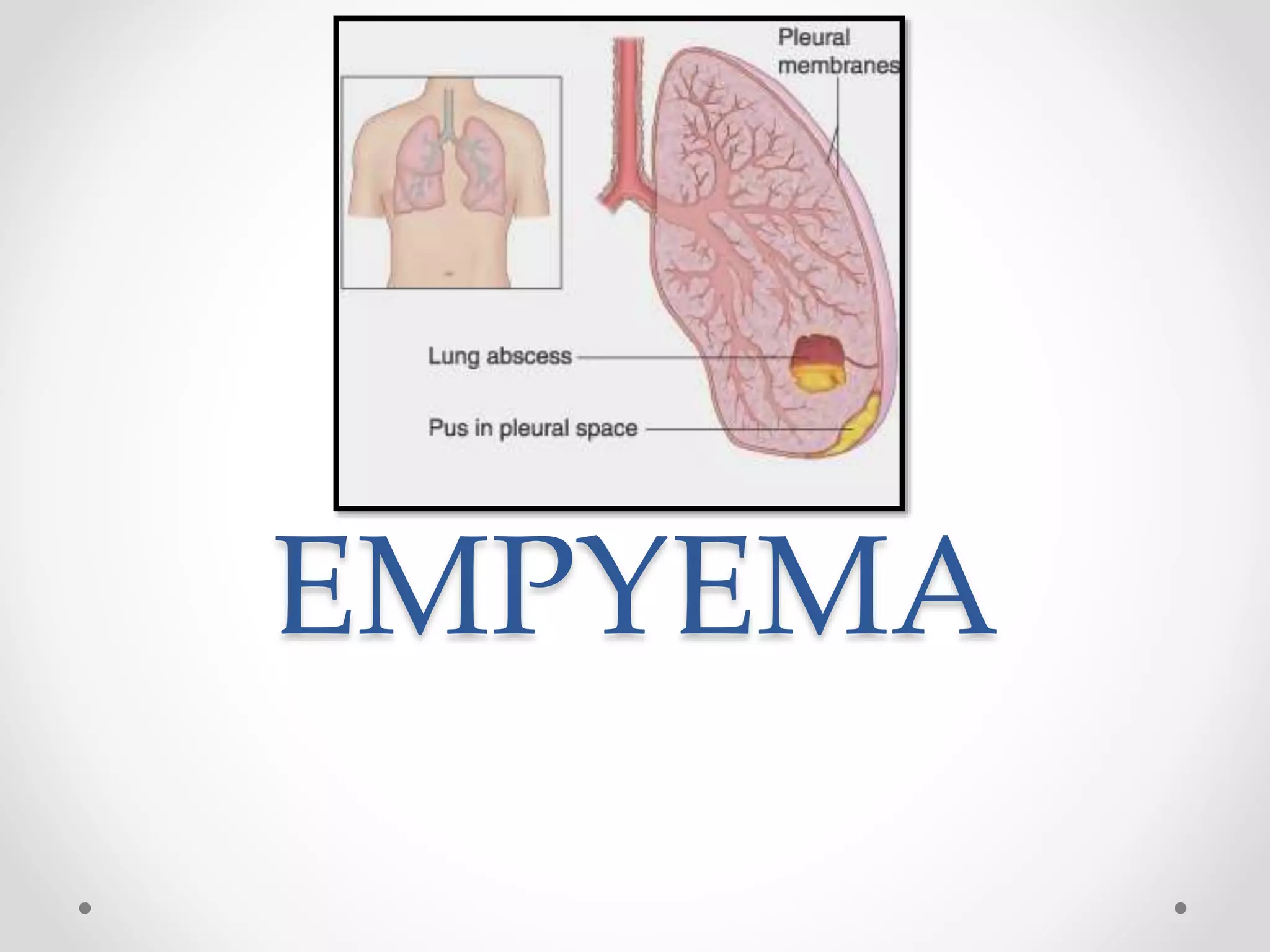 Empyema | PPTX