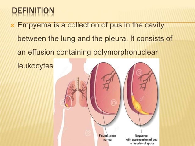 Empyema - Adult Health Nursing . power point | PPT