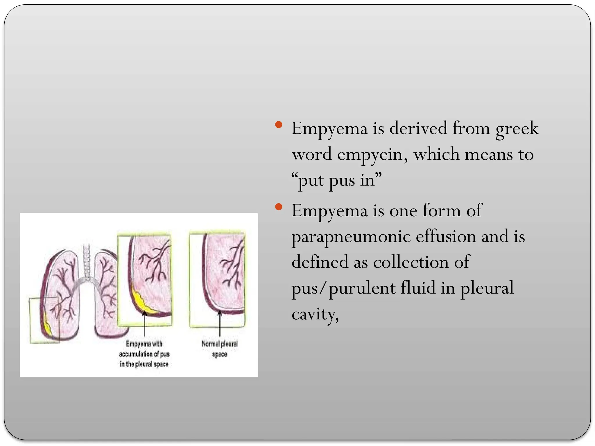 Empyema Thoracis in Pediatrics: Recent Advances | PPTX