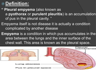 Empyema om new | PPT