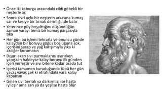 Empyema - Seminar - TR - 2018 | PPT