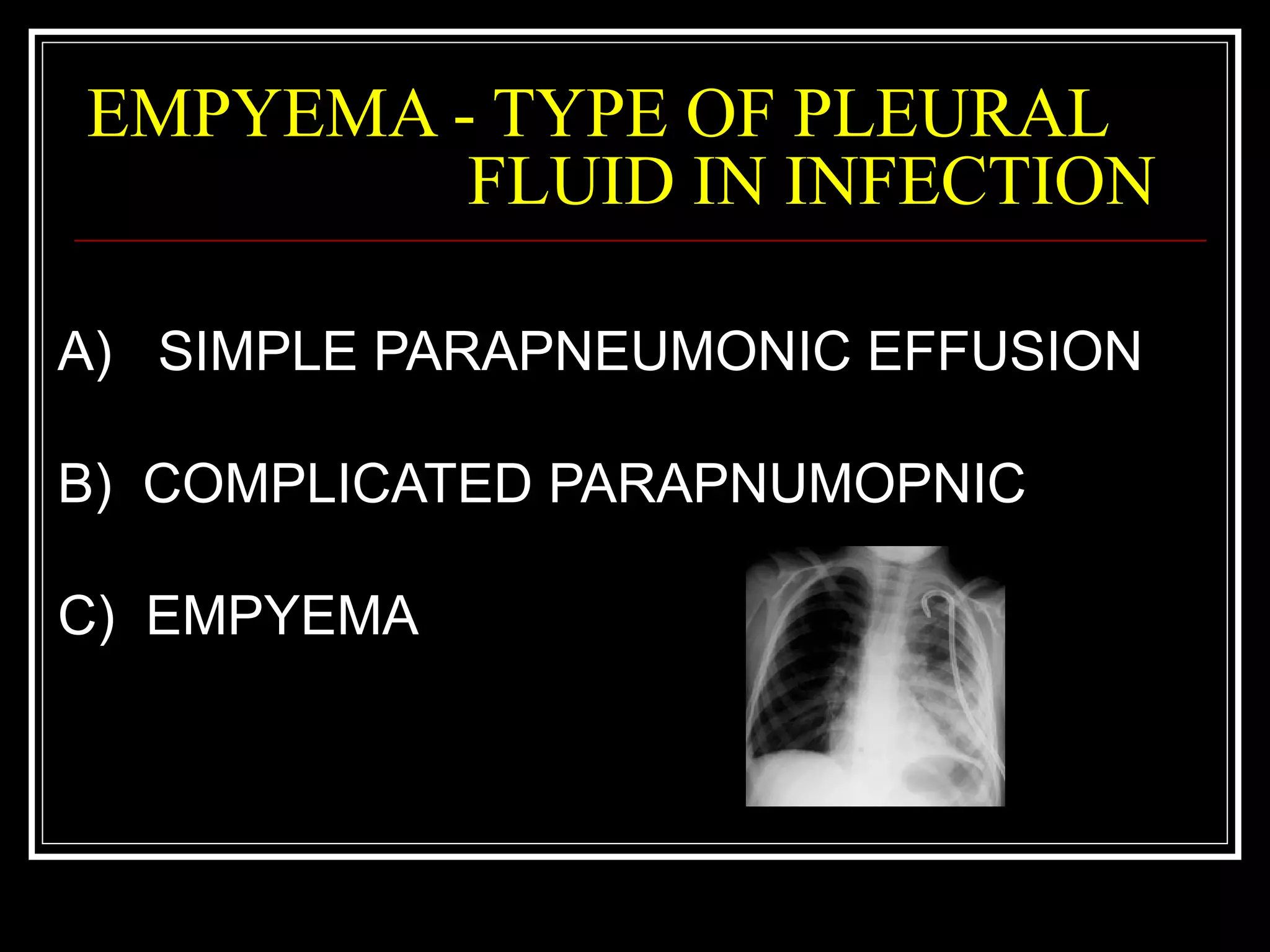 Empyema | PPT