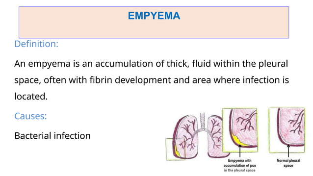 CHAPTER-IV RESPIRATORY SYSTEM empyema .ppt