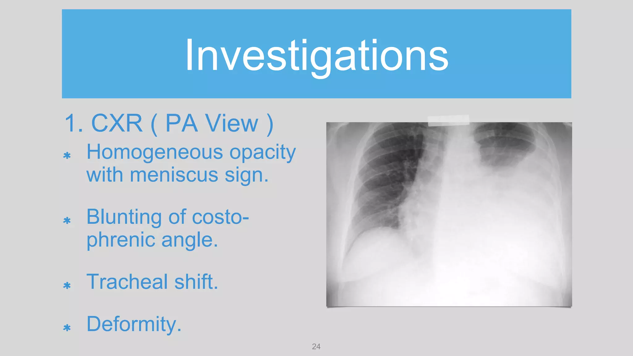 Empyema Thoracis Final.pptx