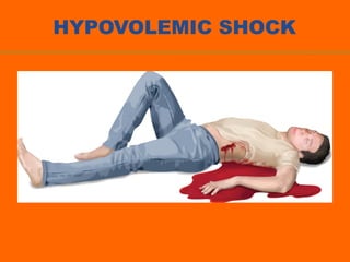 Person In Medical Shock
