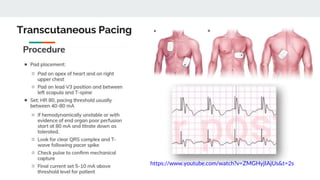 EMS Lecture - Dorian Delgado.pptx
