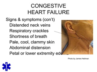 PREVIEW OF EMT/EMR CARDIOVASCULAR EMERGENCIES LESsON | PPTX