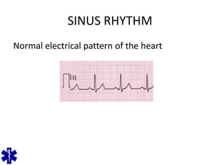 PREVIEW OF EMT/EMR CARDIOVASCULAR EMERGENCIES LESsON | PPTX