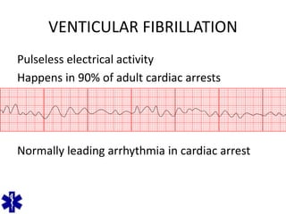 PREVIEW OF EMT/EMR CARDIOVASCULAR EMERGENCIES LESsON | PPTX