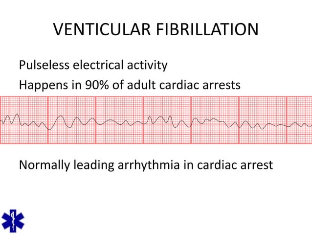 PREVIEW OF EMT/EMR CARDIOVASCULAR EMERGENCIES LESsON | PPTX